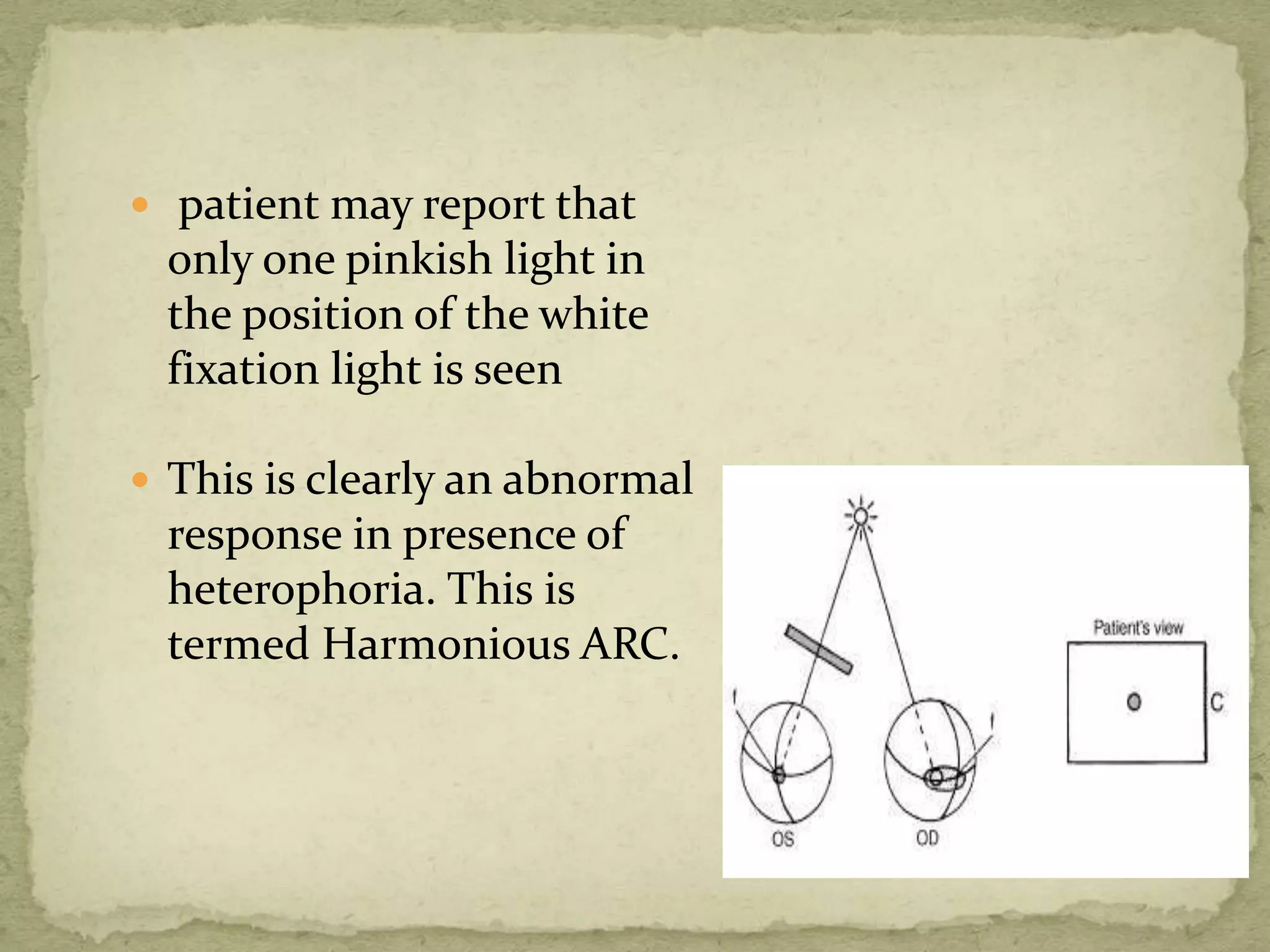 ARC: abnormal retinal correspondence, eccentric fixation | PPTX