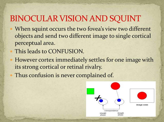 ARC: abnormal retinal correspondence, eccentric fixation | PPTX