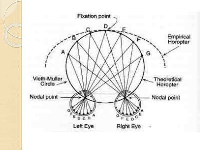 anomalous retinal correspondence | PPTX | Eye and Vision Conditions ...