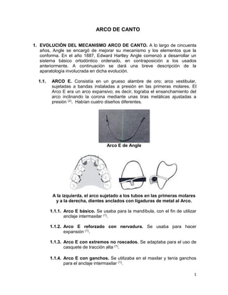 Técnica Arco de Canto - Edgewise - Ortodoncia | PDF