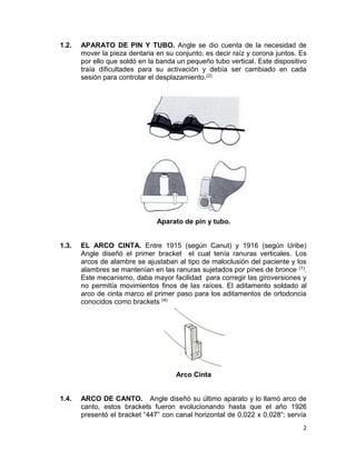 Técnica Arco de Canto - Edgewise - Ortodoncia | PDF
