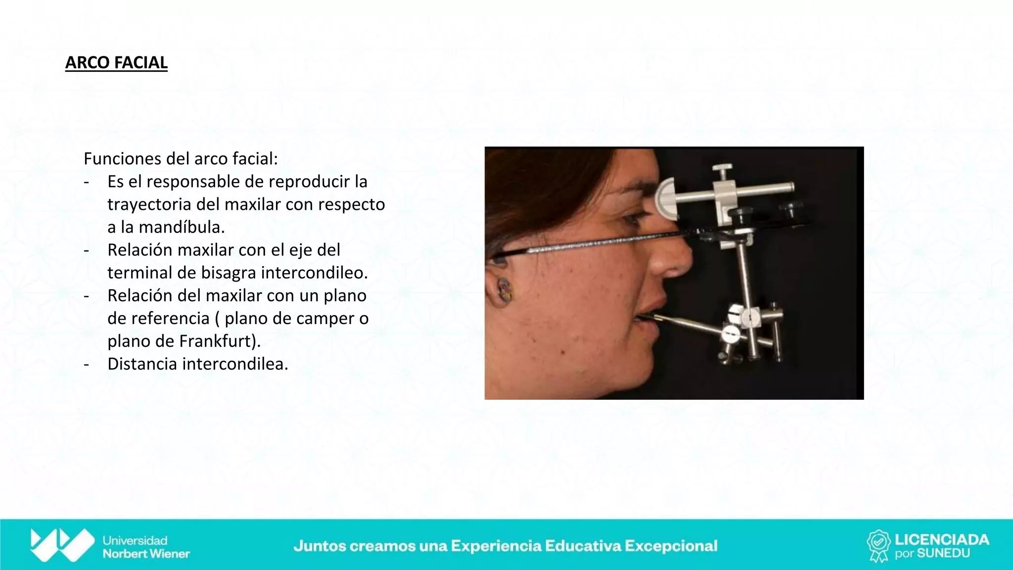 Arco Facial implantología.pptx