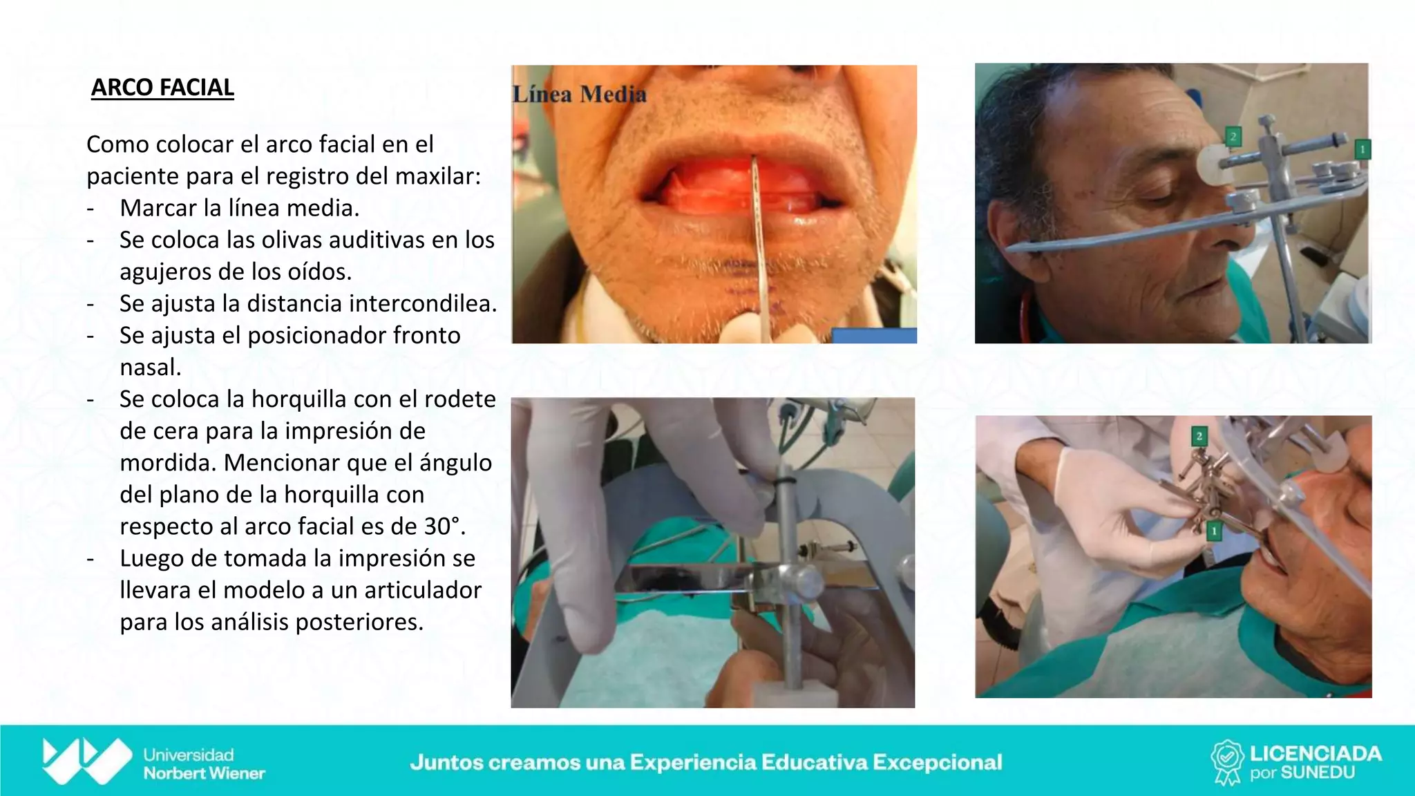 Arco Facial implantología.pptx