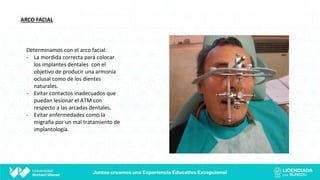 Arco Facial implantología.pptx