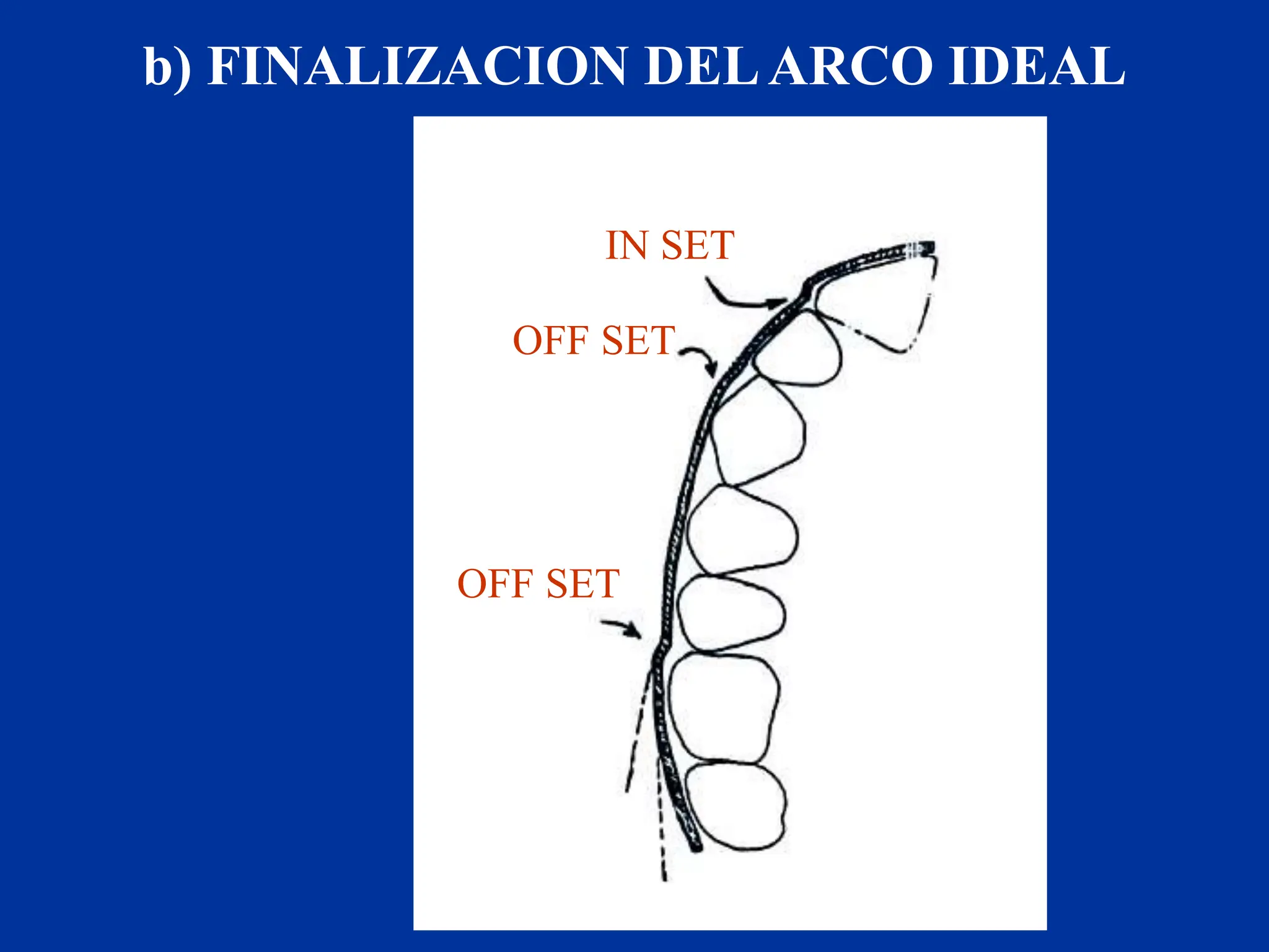 ARCO IDEAL.ppt para realizar tratamientos de ortodoncia. Al iniciar y ...