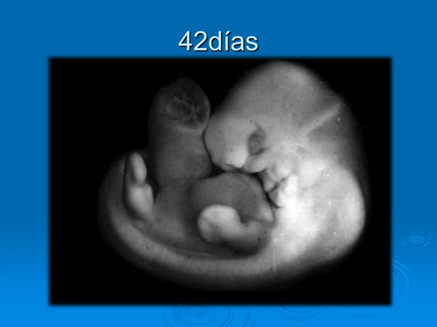 Arcos branquiales | PPTX | Ear, Nose and Throat Conditions | Diseases ...