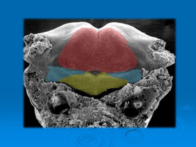Arcos branquiales | PPTX | Ear, Nose and Throat Conditions | Diseases ...