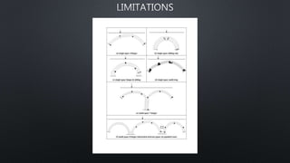 Arcuated structure ppt | PPT