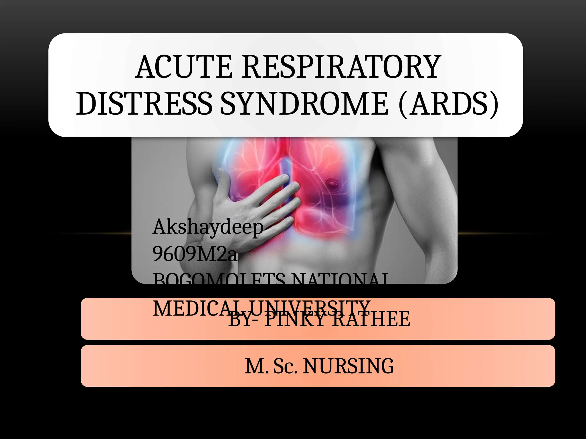 ards-190120193647.pptx ards topic presentation | PPT