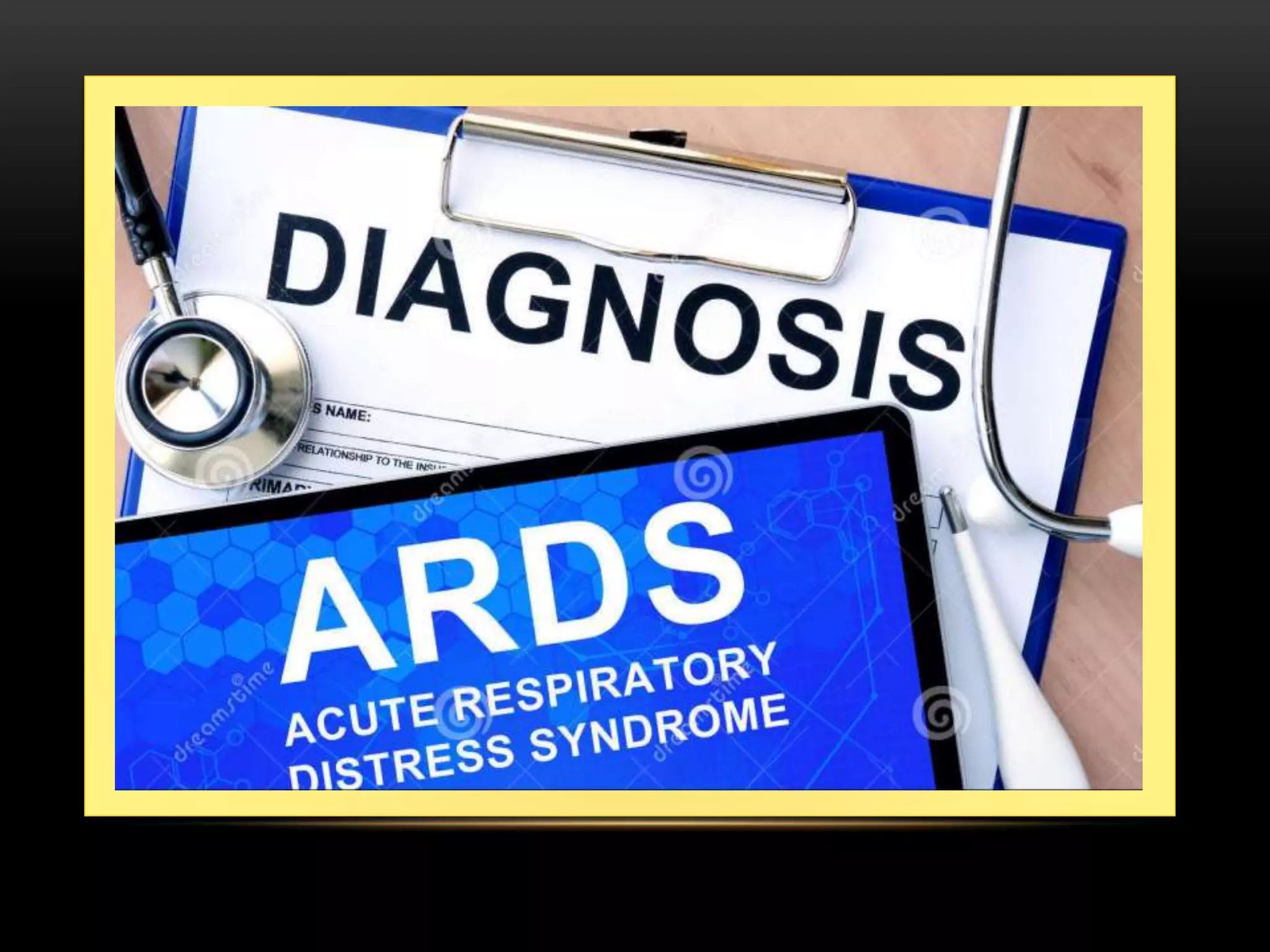Acute respiratory distress syndrome | PPTX
