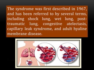 Acute respiratory distress syndrome | PPTX
