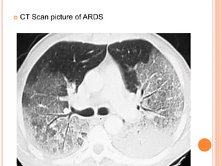 Adult respiratory distress syndrome & nursing care | PPTX