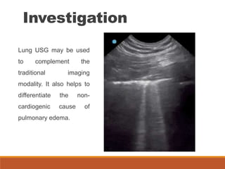 Acute respiratory Distress Syndrome - Medical and Nursing management | PPTX