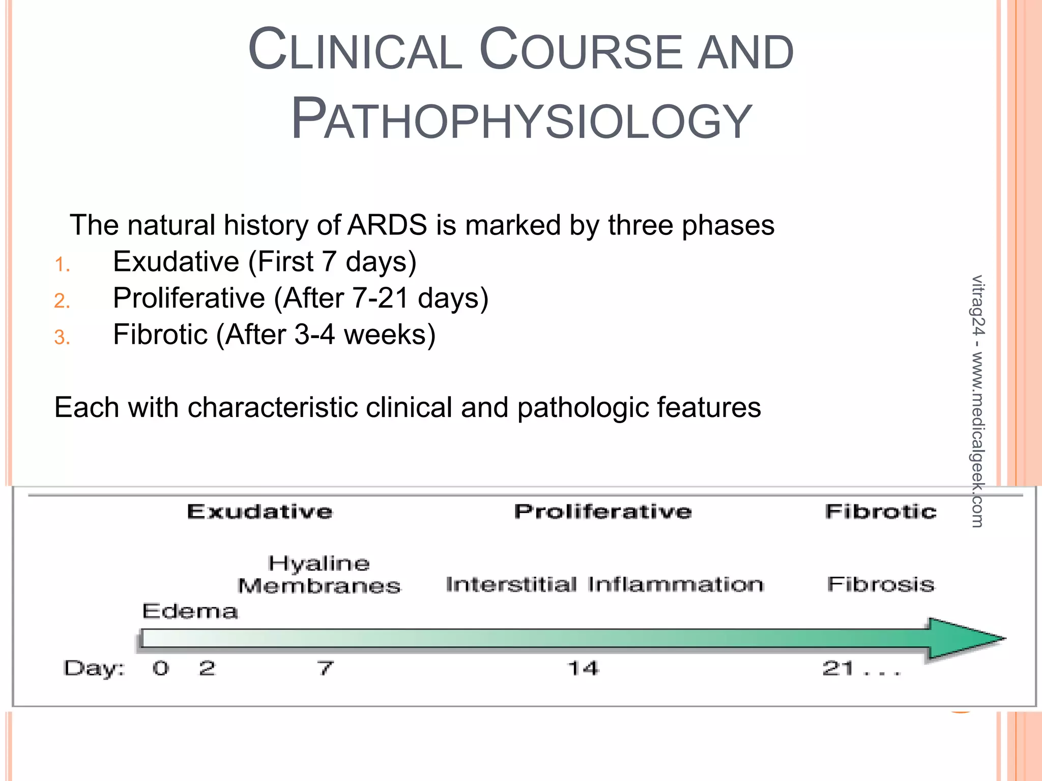 ARDS - Diagnosis and Management | PPTX