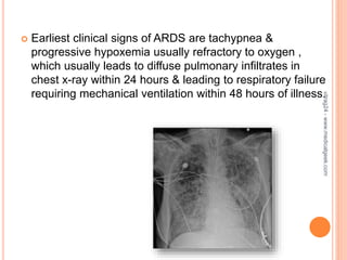 ARDS - Diagnosis and Management | PPTX