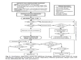 ARDS - Diagnosis and Management | PPTX