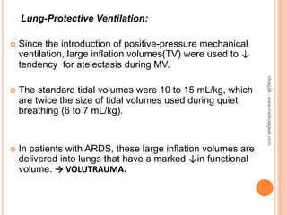 ARDS - Diagnosis and Management | PPTX