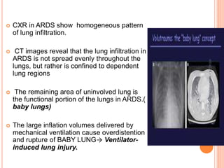 ARDS - Diagnosis and Management | PPTX