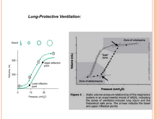 ARDS - Diagnosis and Management | PPTX