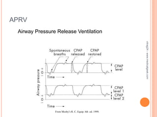 ARDS - Diagnosis and Management | PPTX
