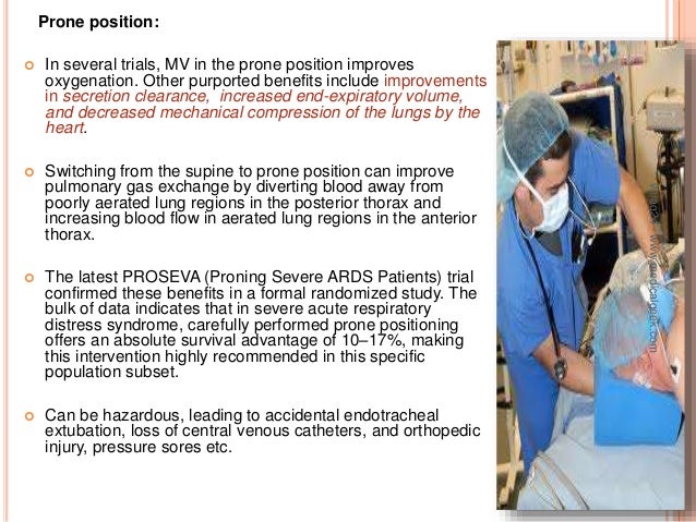 ARDS - Diagnosis and Management