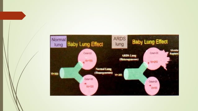 Pediatric ARDS | PPTX | Lung and Respiratory Health | Diseases and ...