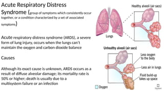 ARDS AND CHEST TROUMA respiratory disorders .pptx