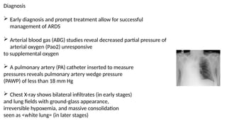 ARDS AND CHEST TROUMA respiratory disorders .pptx