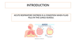 ARDS (Acute respiratory distress syndrome).pptx