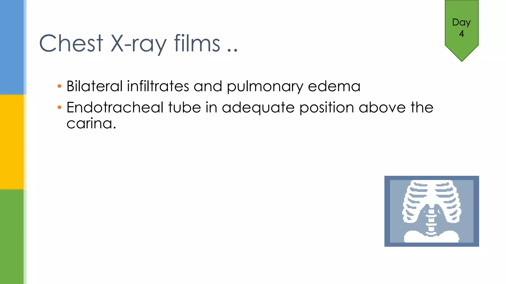 ARDS (Case study) | PPTX
