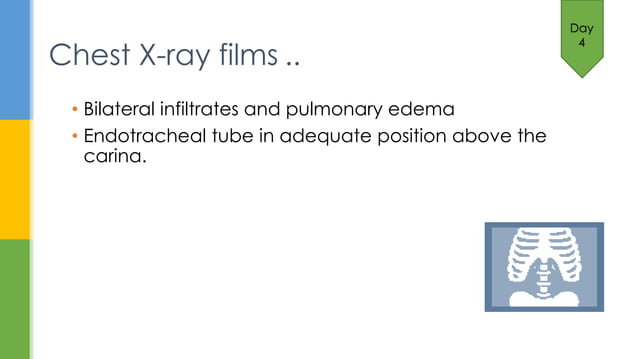ARDS (Case study) | PPTX | Lung and Respiratory Health | Diseases and Conditions