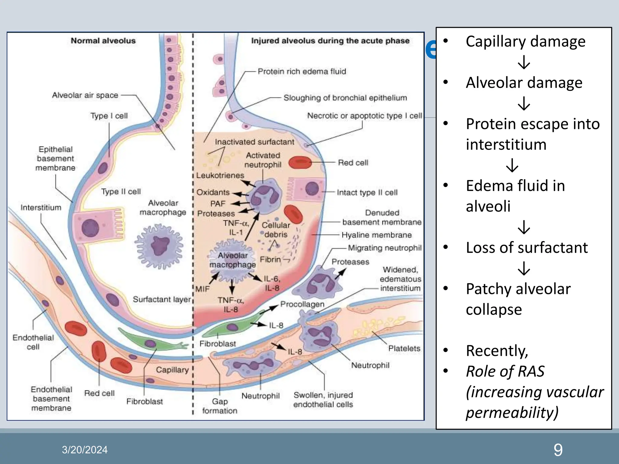 Acute respiratory distress syndrome ARDS.pptx