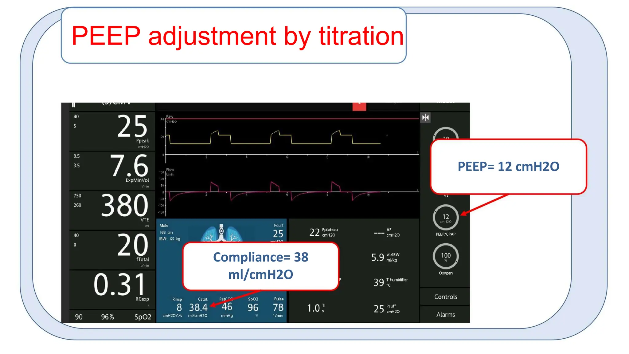 New ARDS management guideline_who_..pptx
