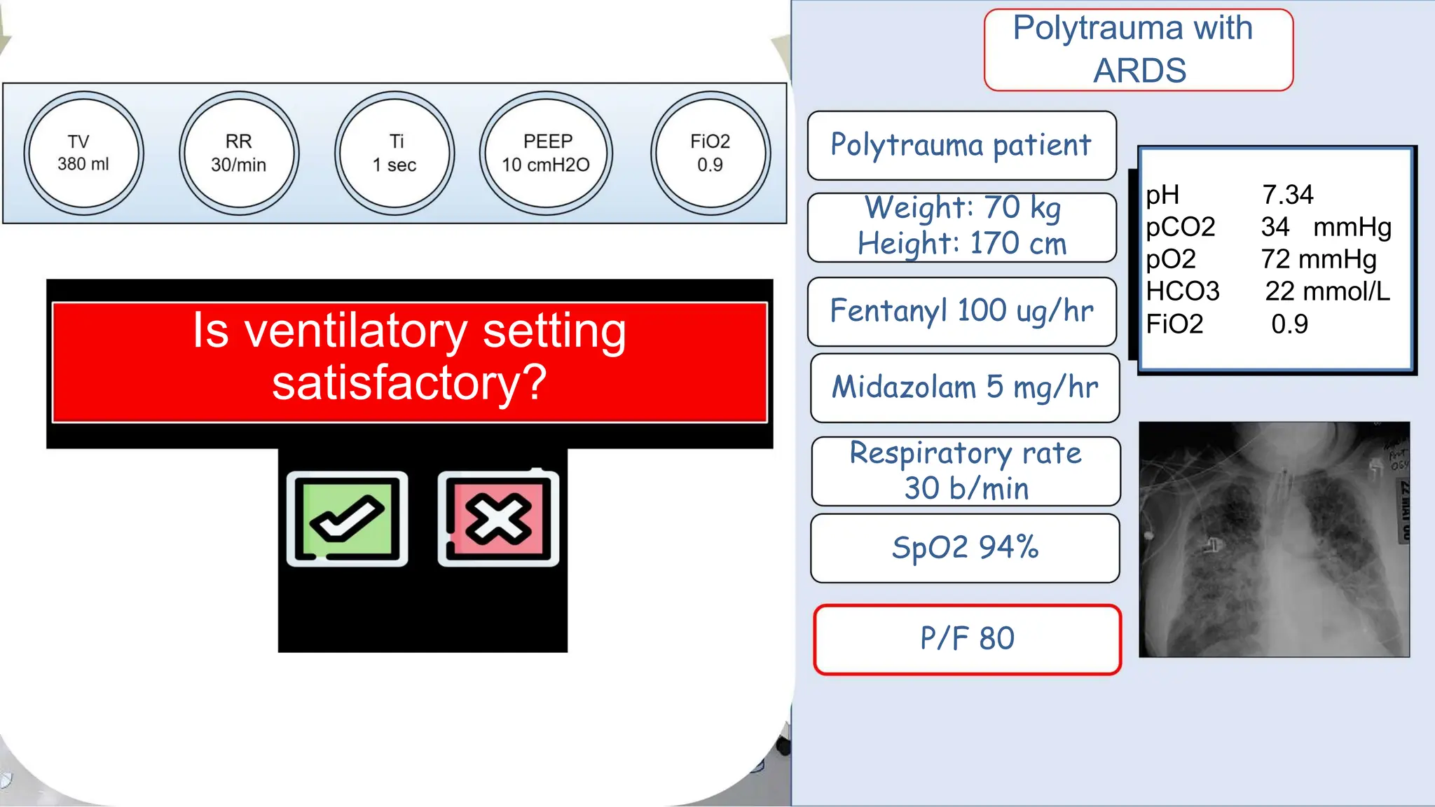 New ARDS management guideline_who_..pptx