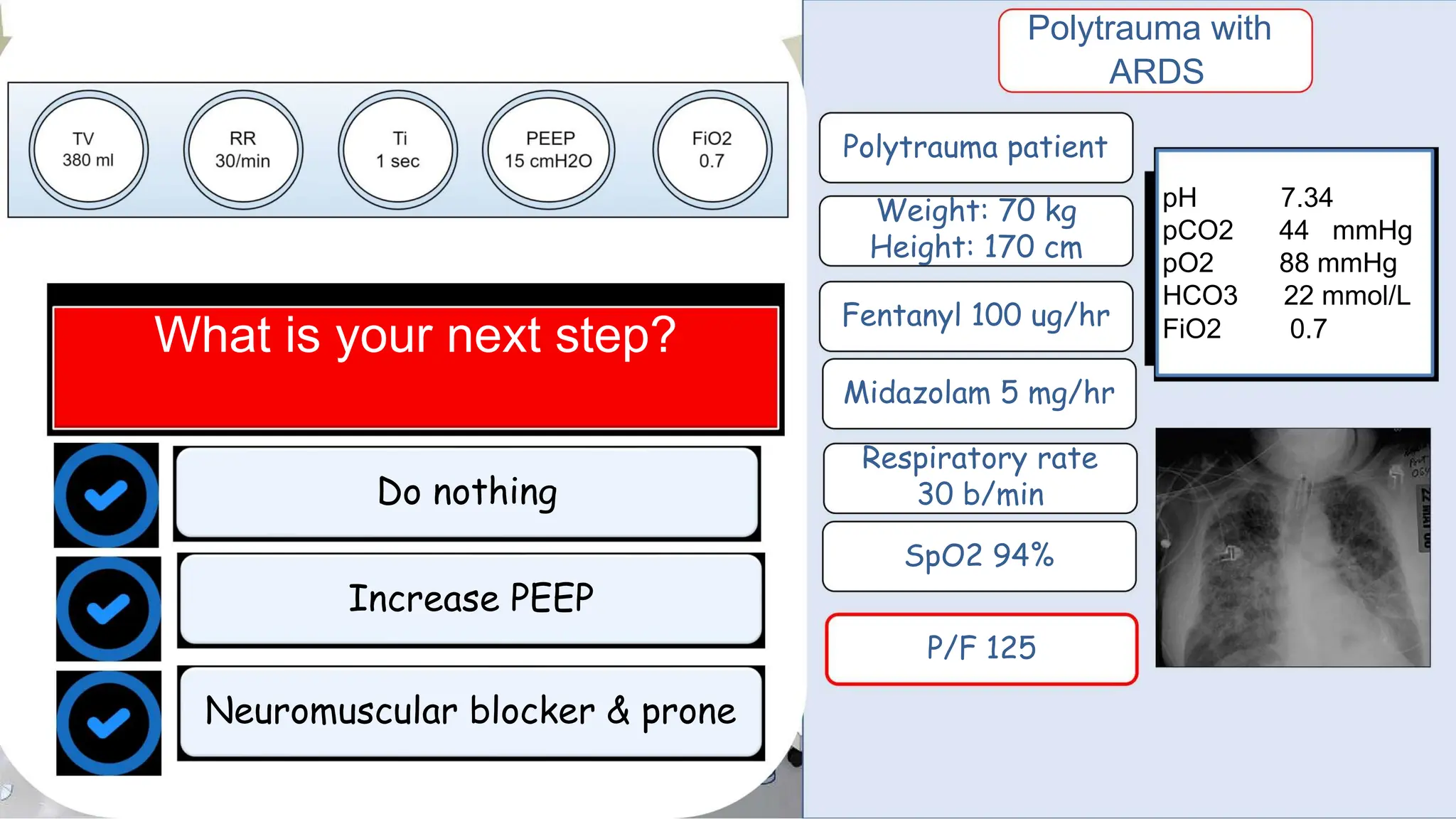 New ARDS management guideline_who_..pptx