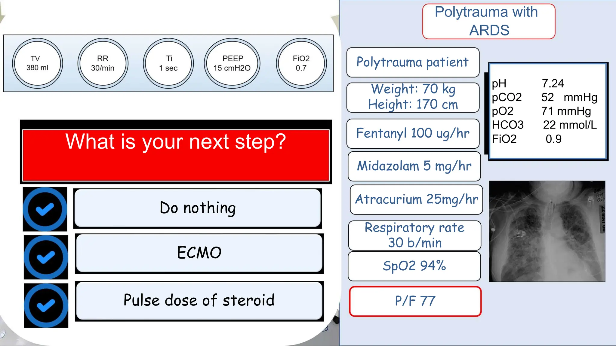New ARDS management guideline_who_..pptx