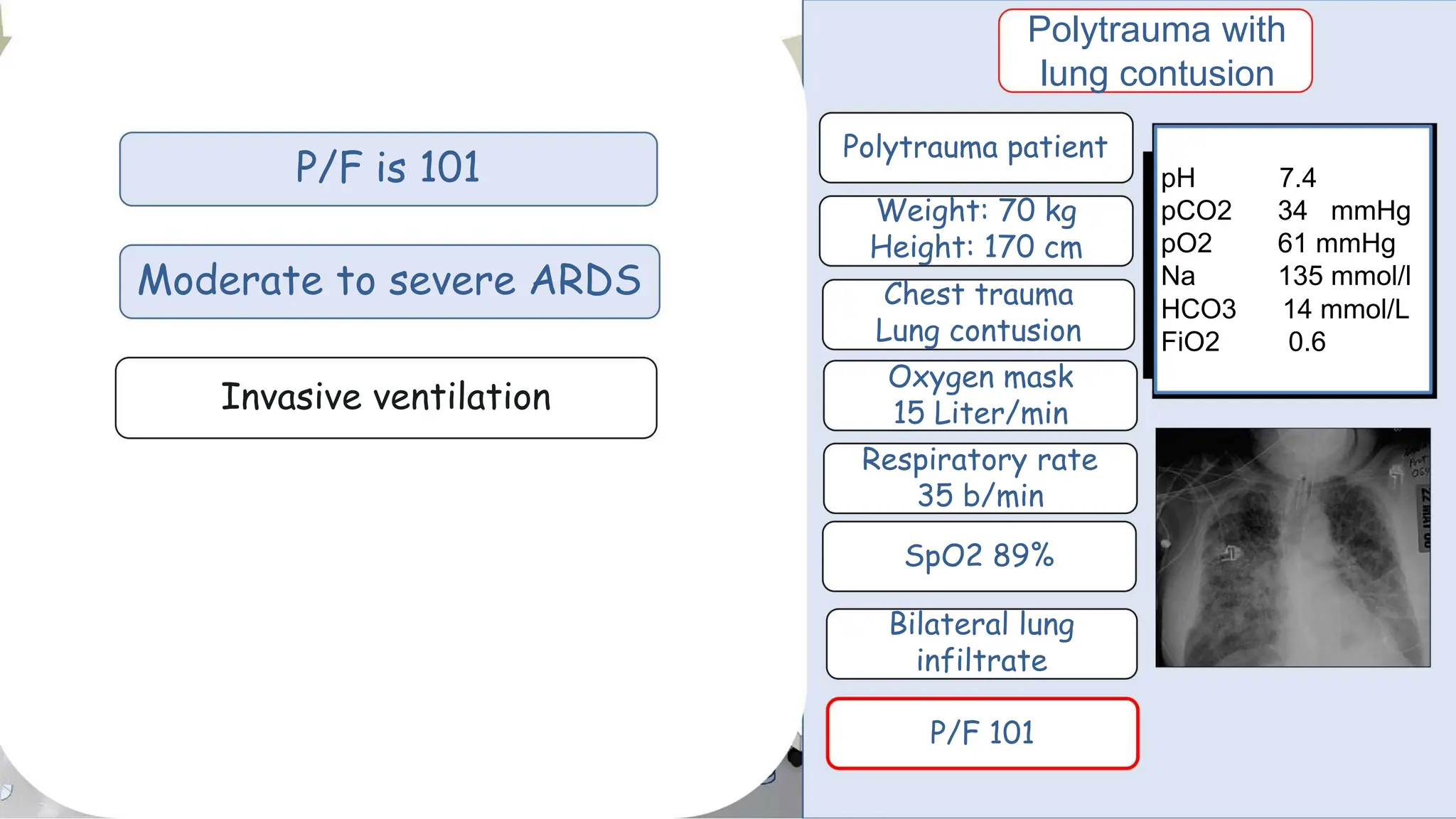 New ARDS management guideline_who_..pptx