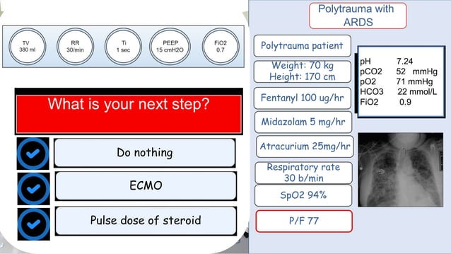 New ARDS management guideline_who_..pptx | Lung and Respiratory Health ...