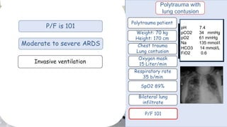 New ARDS management guideline_who_..pptx