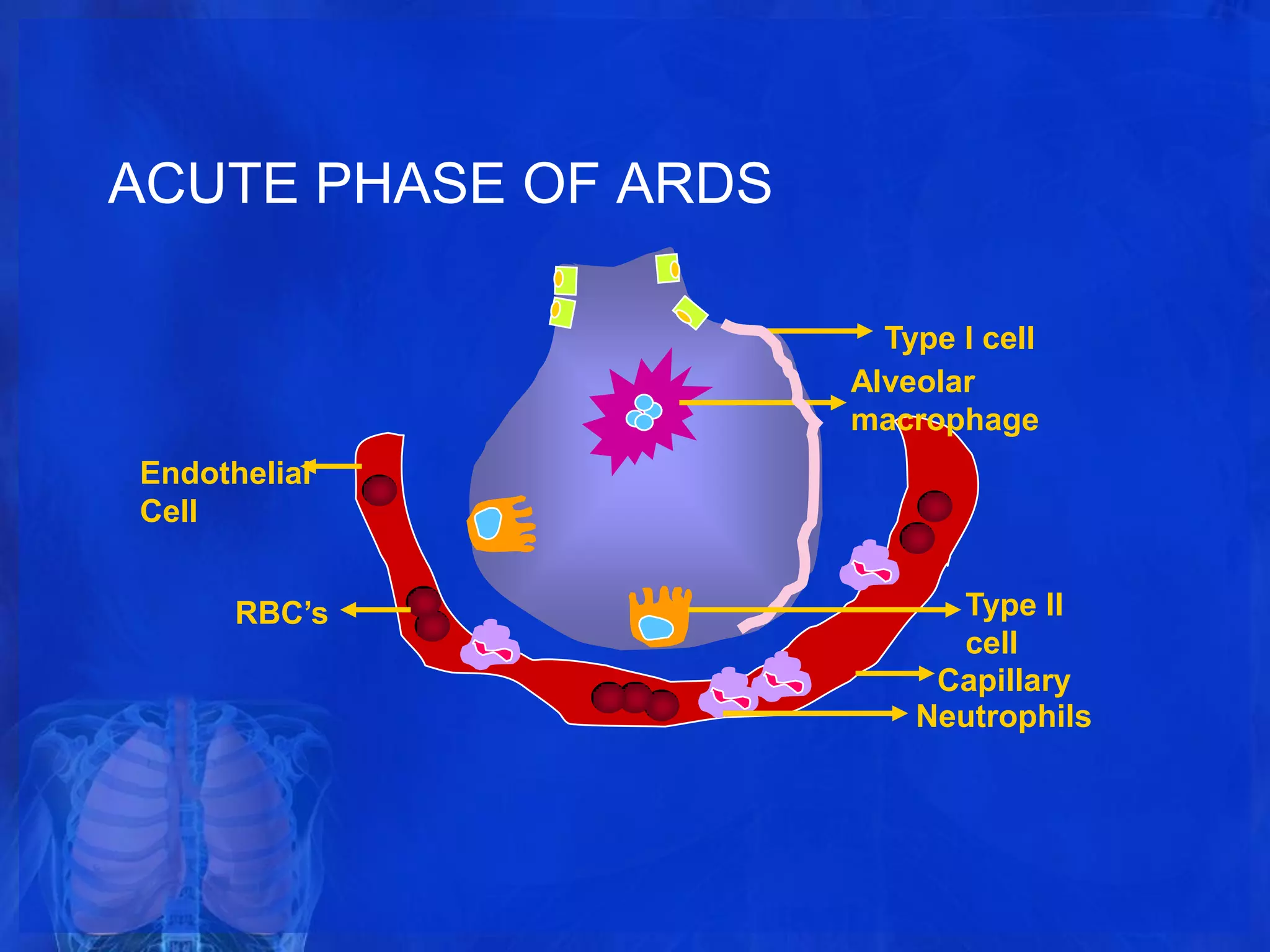 Ards new | PPTX