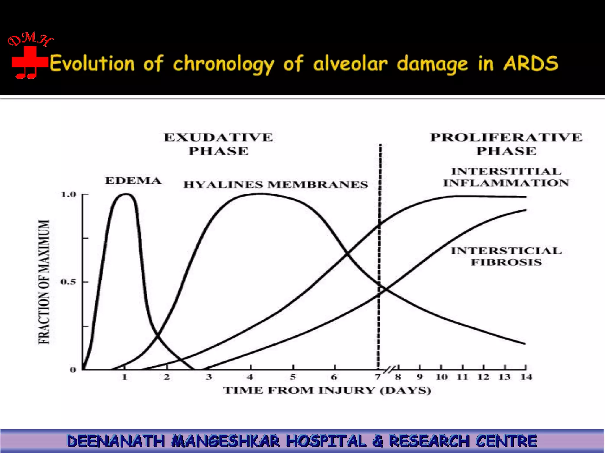 ARDS PATHO PHYSIOLOGY 1.pptx