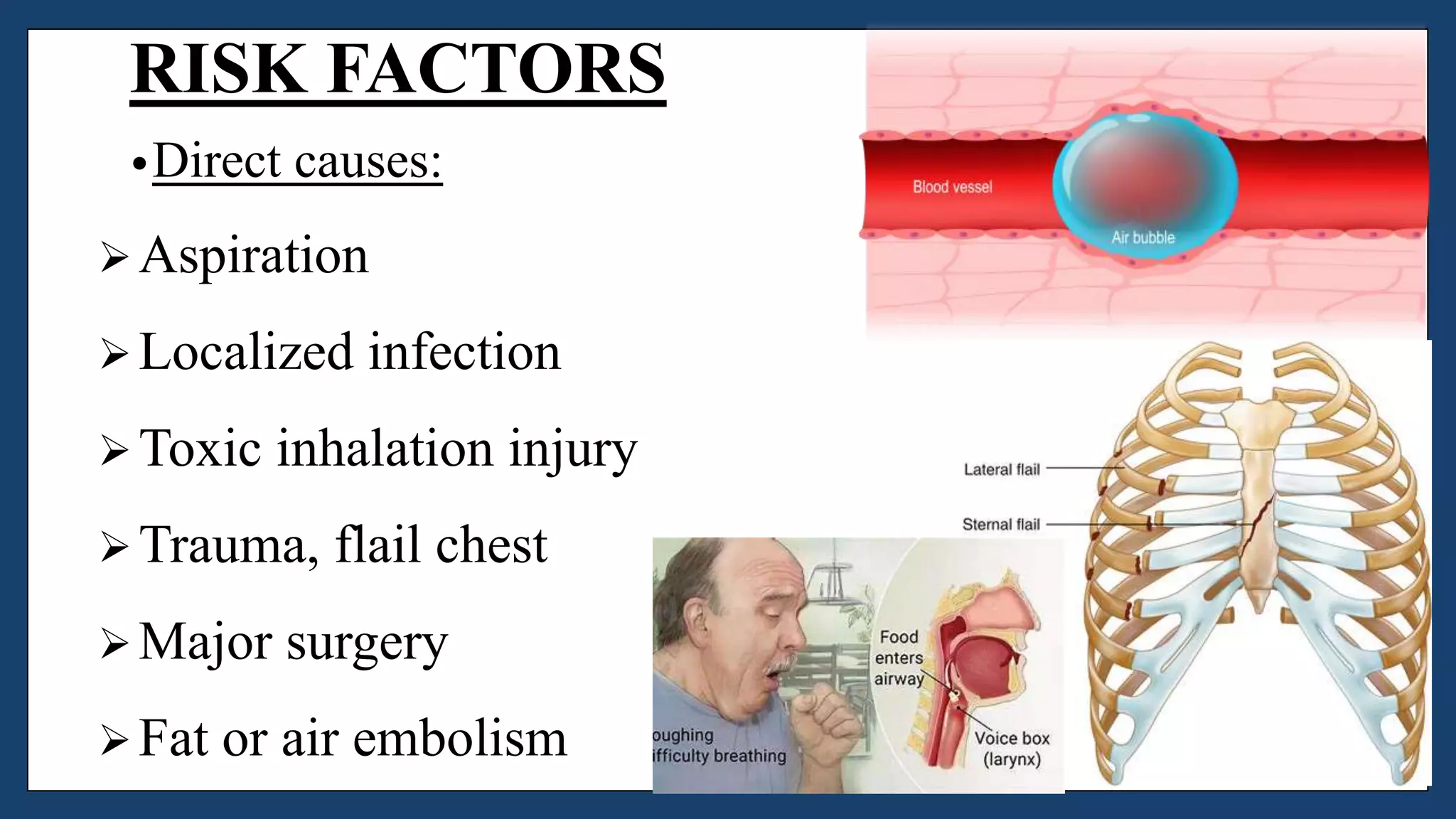 ARDS (acute respiratory distress syndrome) ppt SlideShare | PPTX