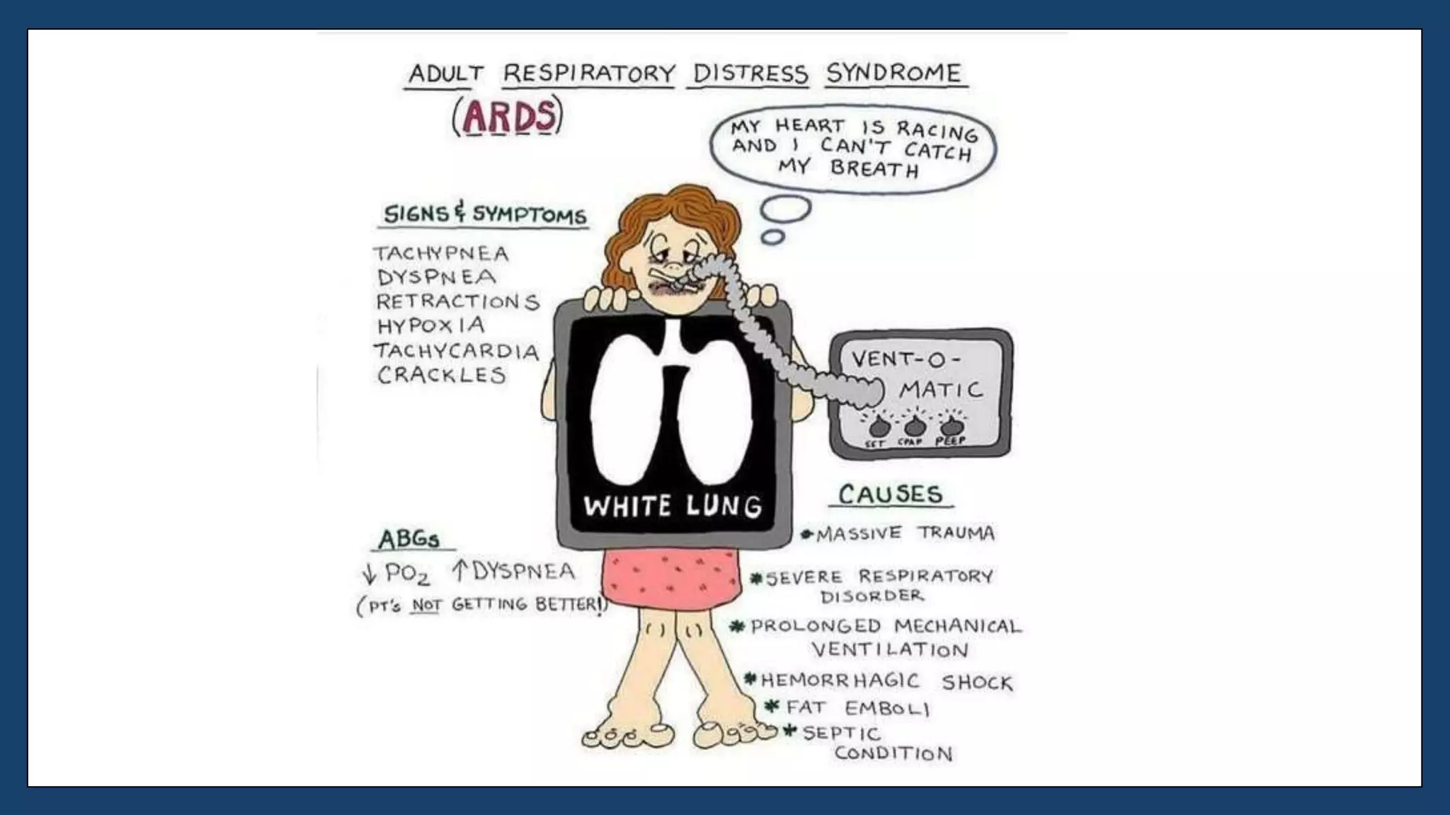 ARDS (acute respiratory distress syndrome) ppt SlideShare | PPTX