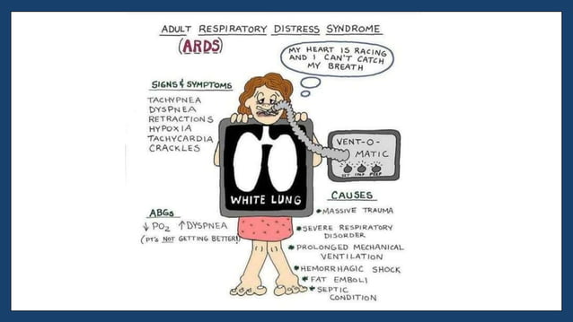 ARDS (acute respiratory distress syndrome) ppt SlideShare | PPTX
