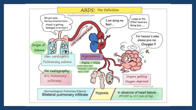 ARDS (acute respiratory distress syndrome) ppt SlideShare | PPTX