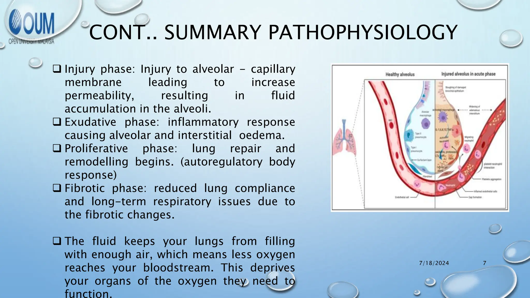 ARDS_Presentation.pptx acute respiratory disease syndrome | PPTX | Lung and Respiratory Health ...
