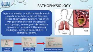 ARDS_Presentation.pptx acute respiratory disease syndrome | PPTX | Lung ...