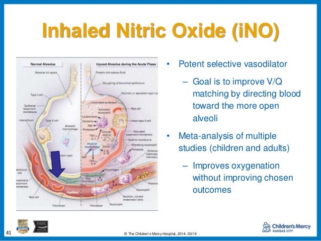 ARDS: The Old and the New (-ish)