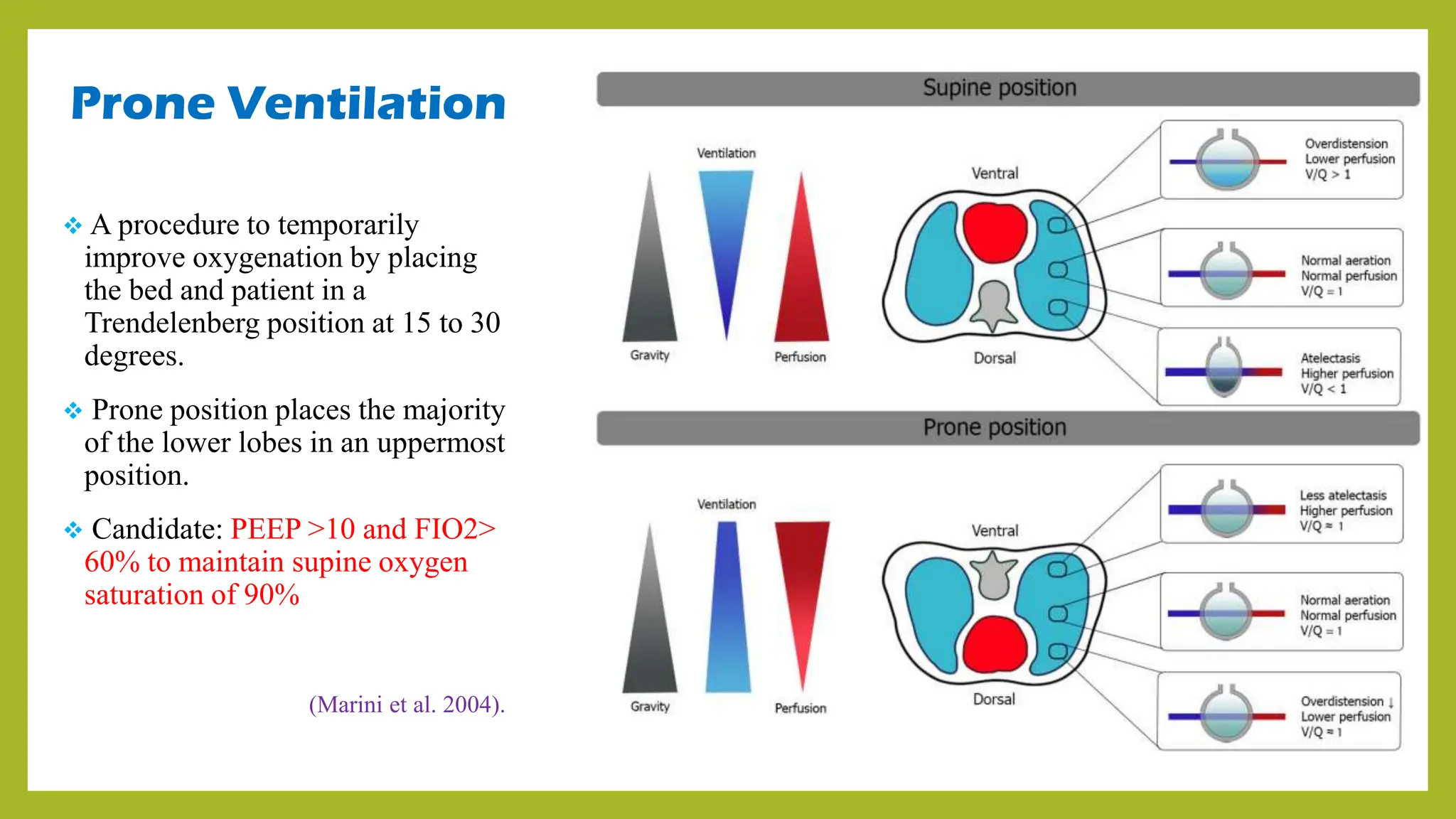 VENTILATORY STRATEGY IN ARDS CHANDAN.pdf