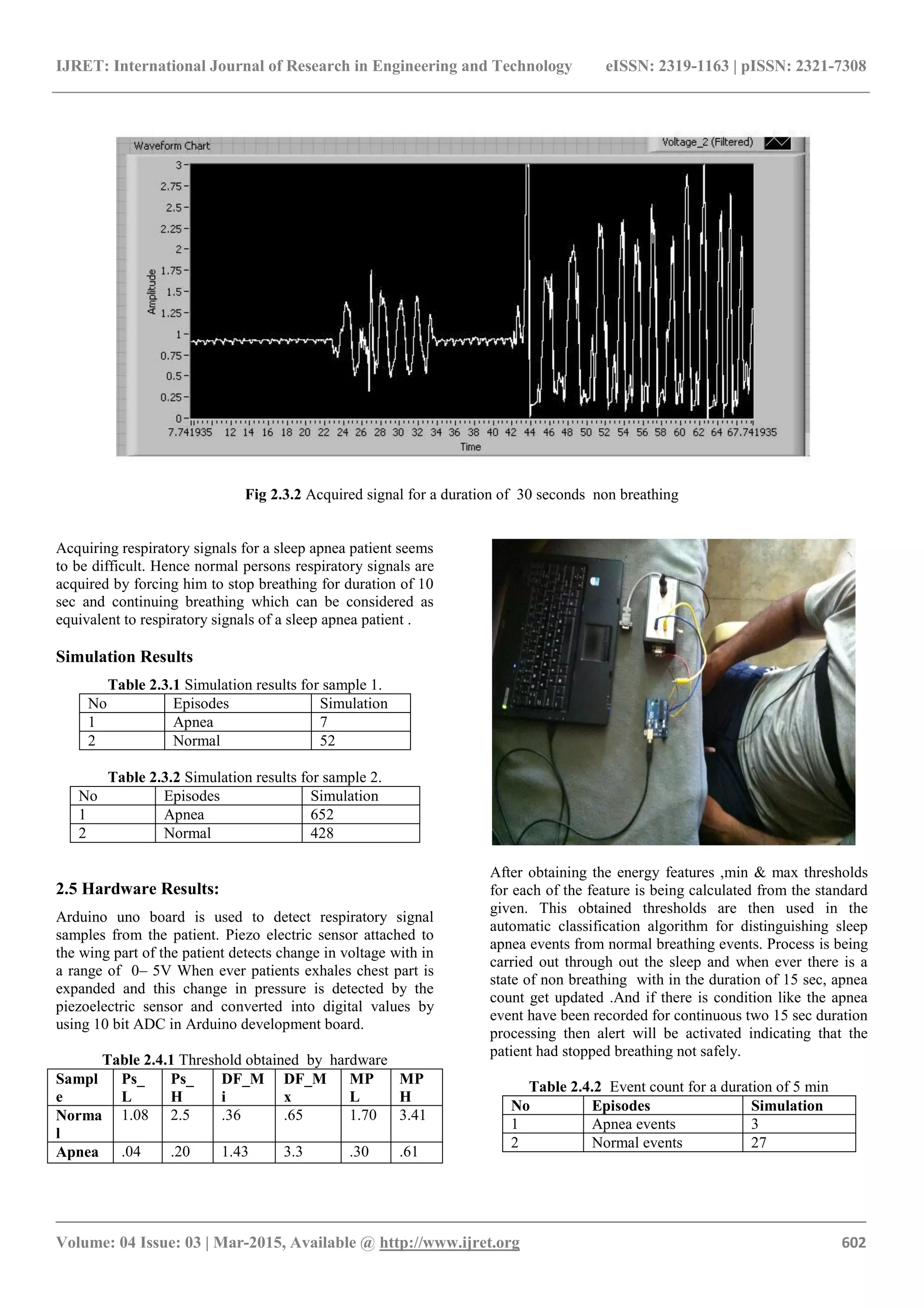Arduino Uno Based Obstructive Sleep Apnea Detection Using Respiratory